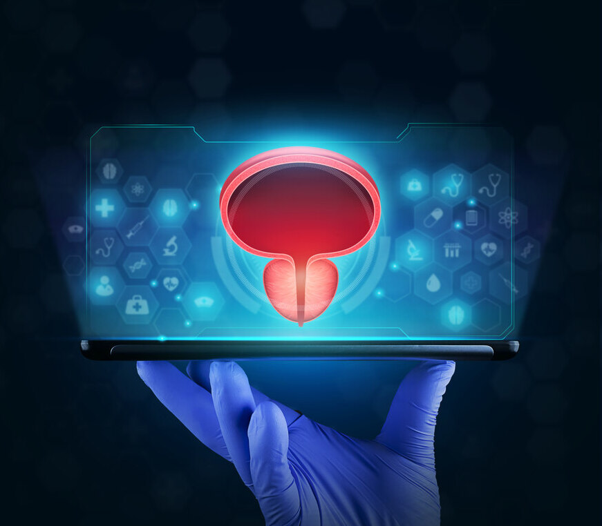 Holep: a cirurgia a laser que redefine o tratamento da próstata ...